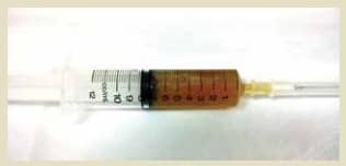 Breast Cyst Fact Sheet | Westmead BCI