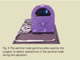 Sentinel Node Biopsy | Westmead BCI